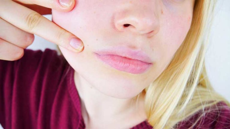 Crema post laser: quale usare dopo il trattamento di epilazione ...